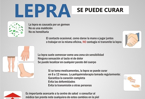 Lepra: la importancia del diagnóstico precoz - ActualidadChaco.com - Resistencia - Chaco